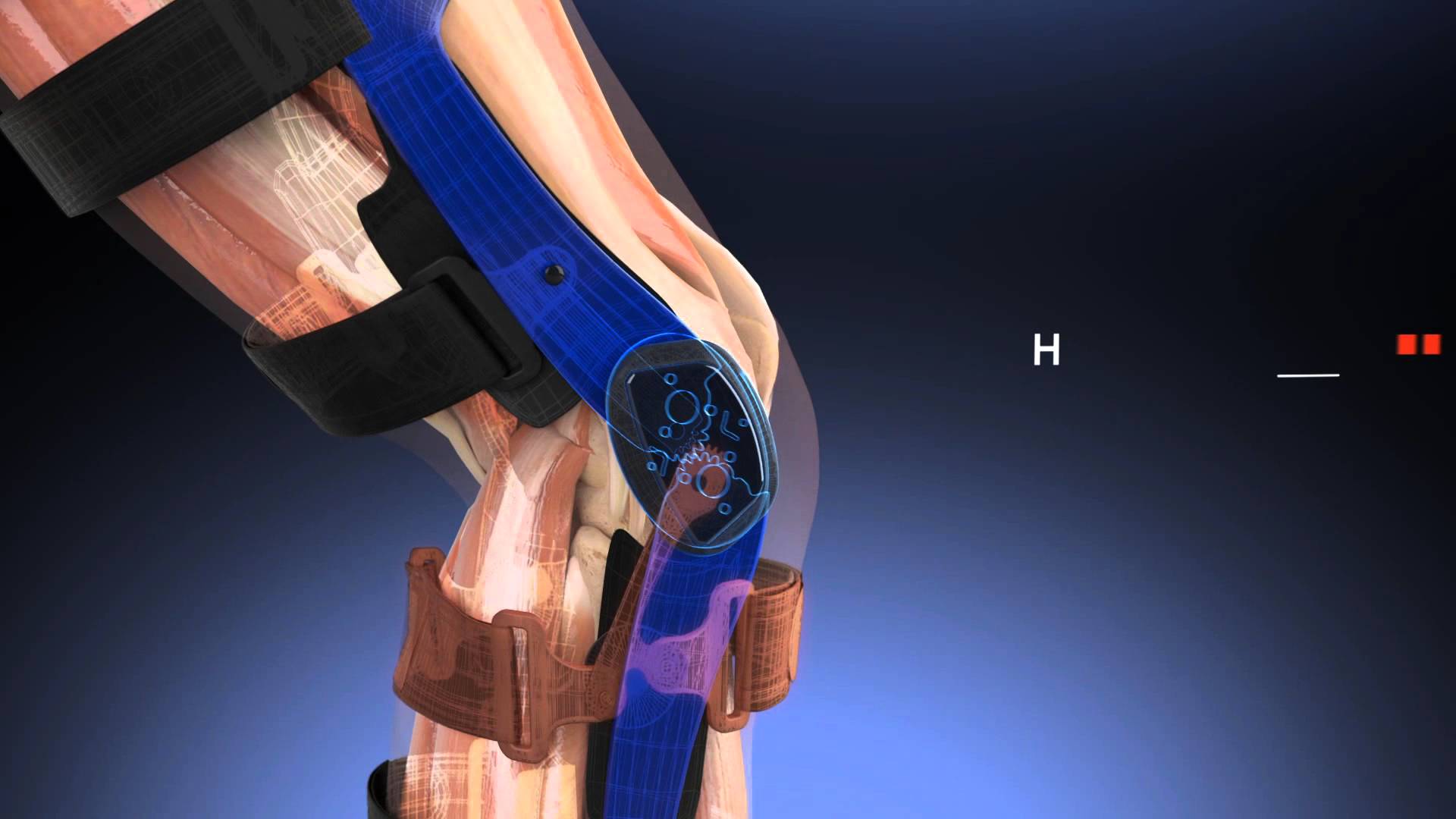 Breg Dynamic Braces Technology – Breg, Inc.